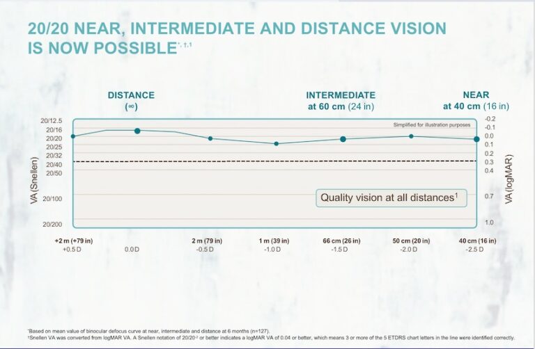 PanOptix Lens (IOL) - Gary Foster MD